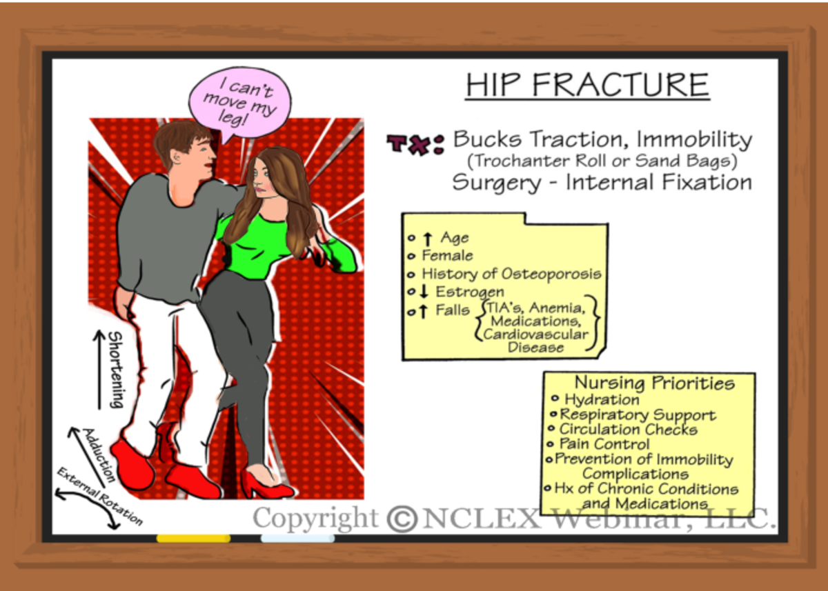 Mnemonics 200 e-Flashcards - HIP FRACTURE move leg! Bucks Traction ...