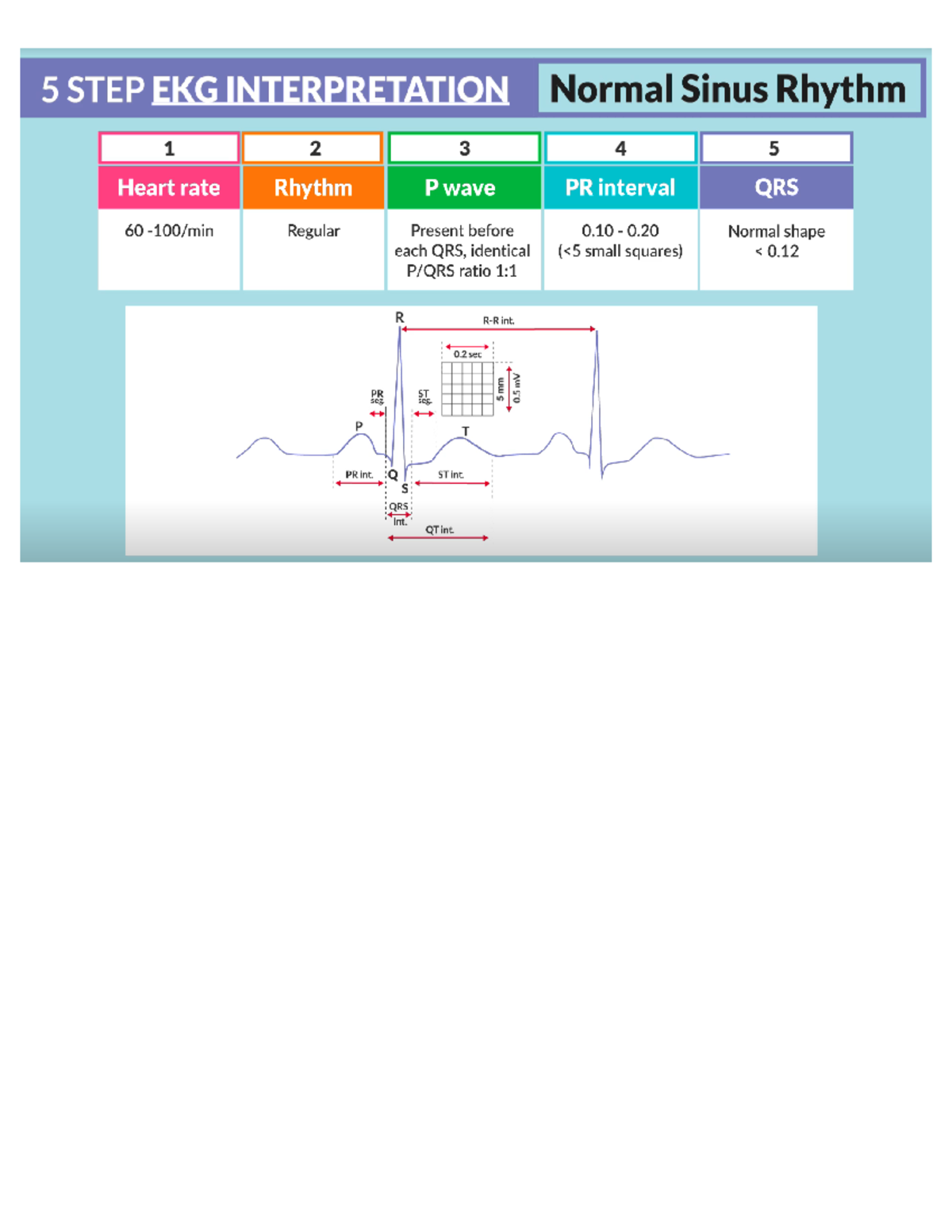 How to read ECG tracing - Medical Surgical Nursing - Studocu