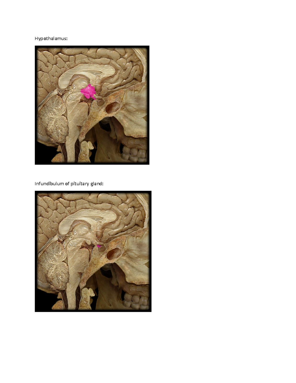 Lab 1 APR - apr - BIOL 153 - Hypothalamus: Infundibulum of pituitary ...