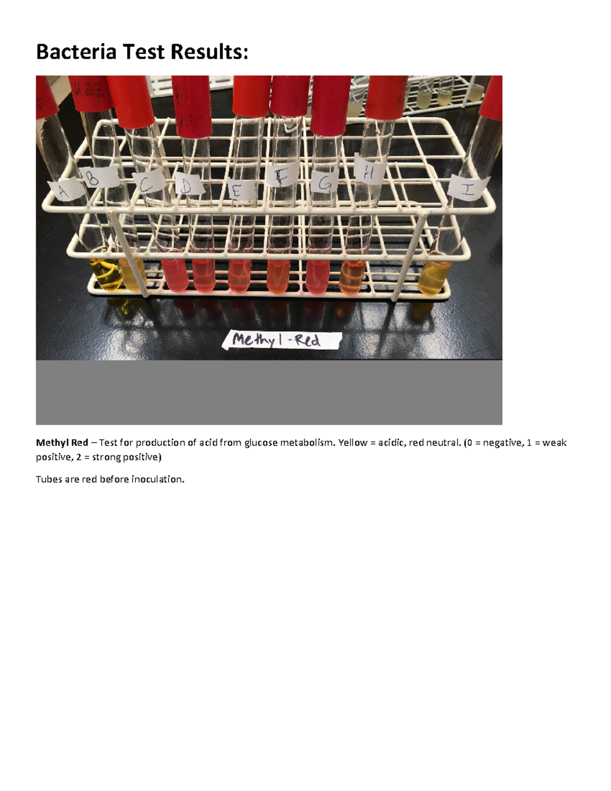 Bacteria test results - Lecture Notes - Bacteria Test Results: Methyl ...