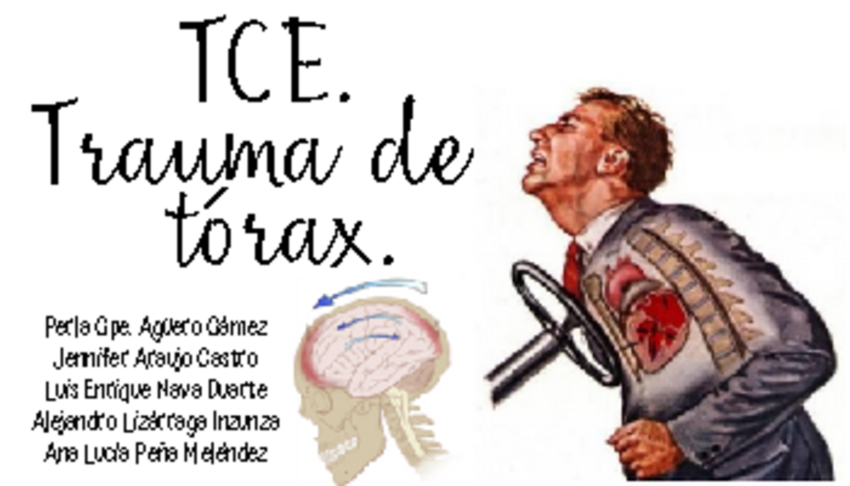 Politrauma - ndnme - TCE. Trauma de tórax. Perla Gpe. Agüero Gámez ...