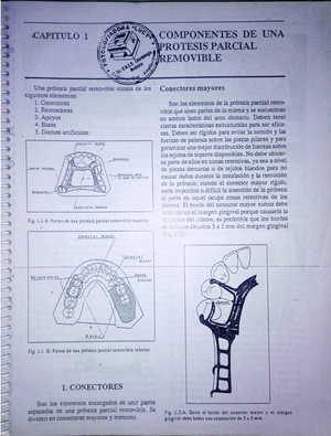 Infografia Final de protesis removible caso clinico paso a paso para ...