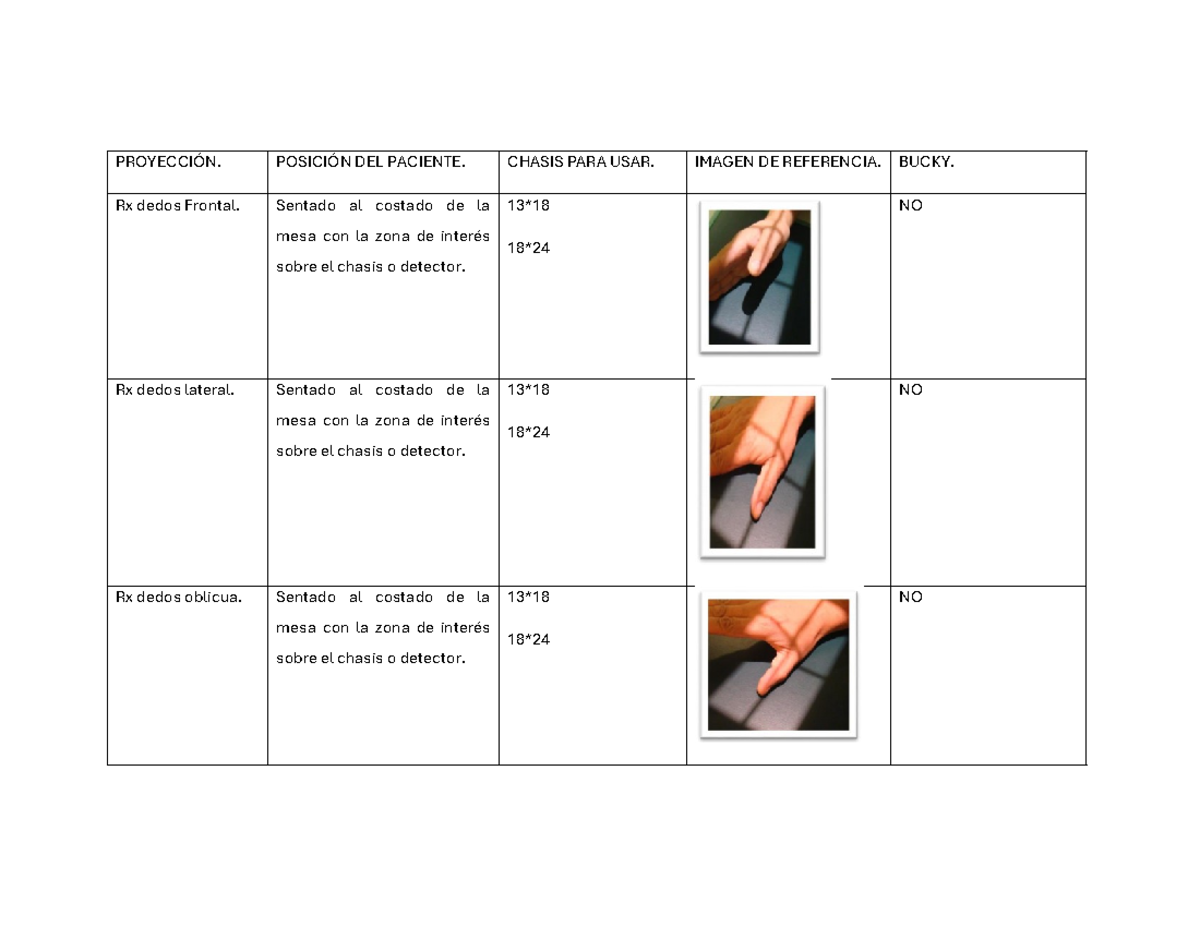Proyecciones Rx. - PROYECCIÓN. POSICIÓN DEL PACIENTE. CHASIS PARA USAR ...