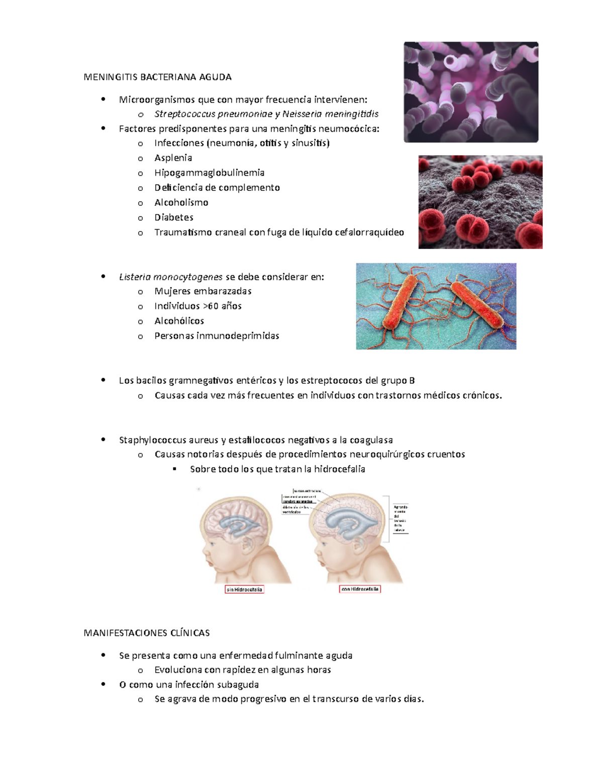 Meningitis Bacteriana Aguda - MENINGITIS BACTERIANA AGUDA ...