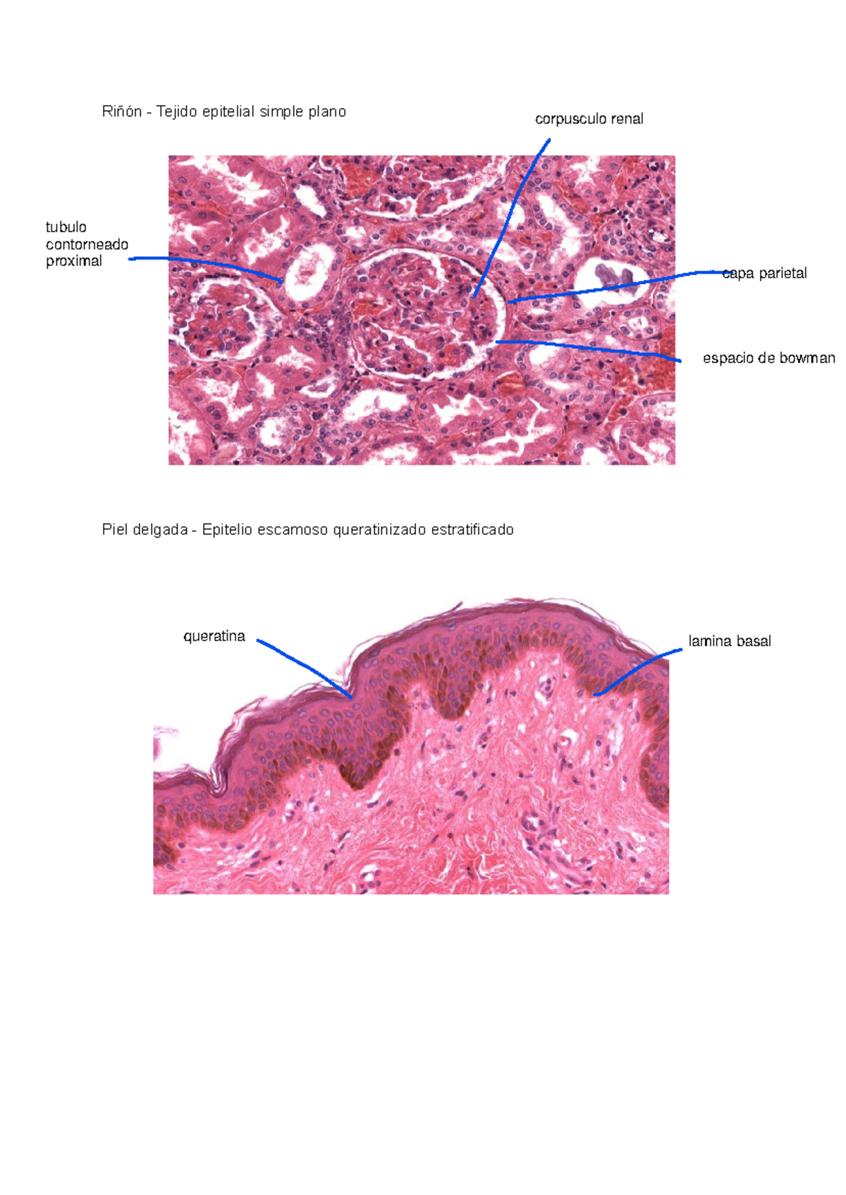 Histo general - hgjhjggjgc - Riñón - Tejido epitelial simple plano Piel ...