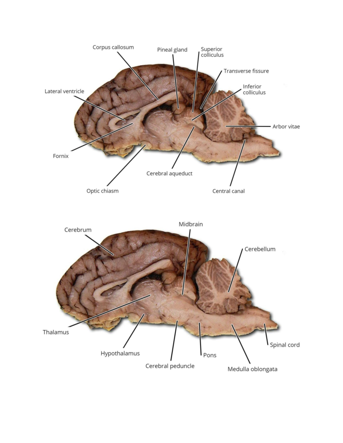 Brain Atlas - Guide for identification of parts - Corpus callosum ...