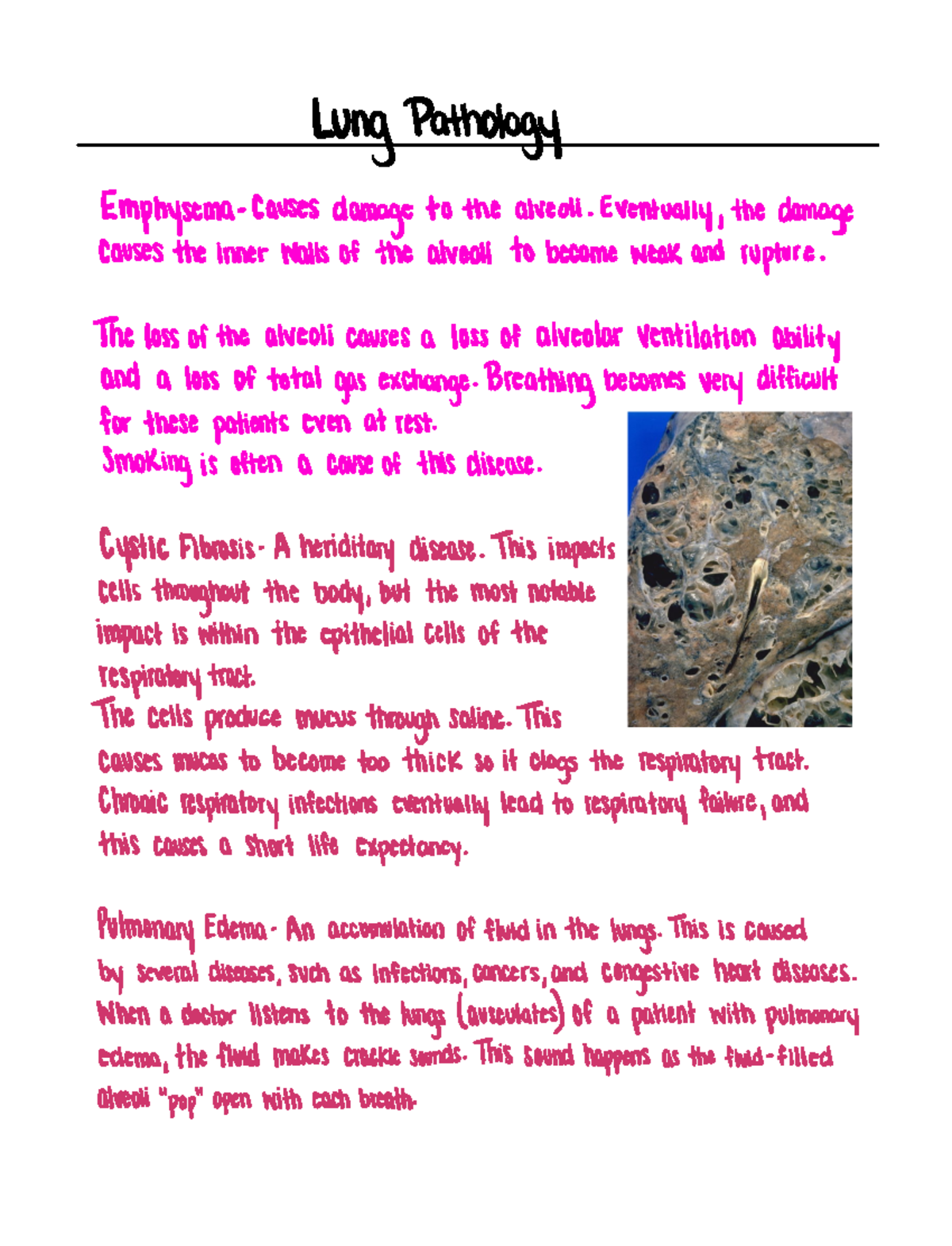 Lung Pathology - Here are my notes I took from the lecture ...