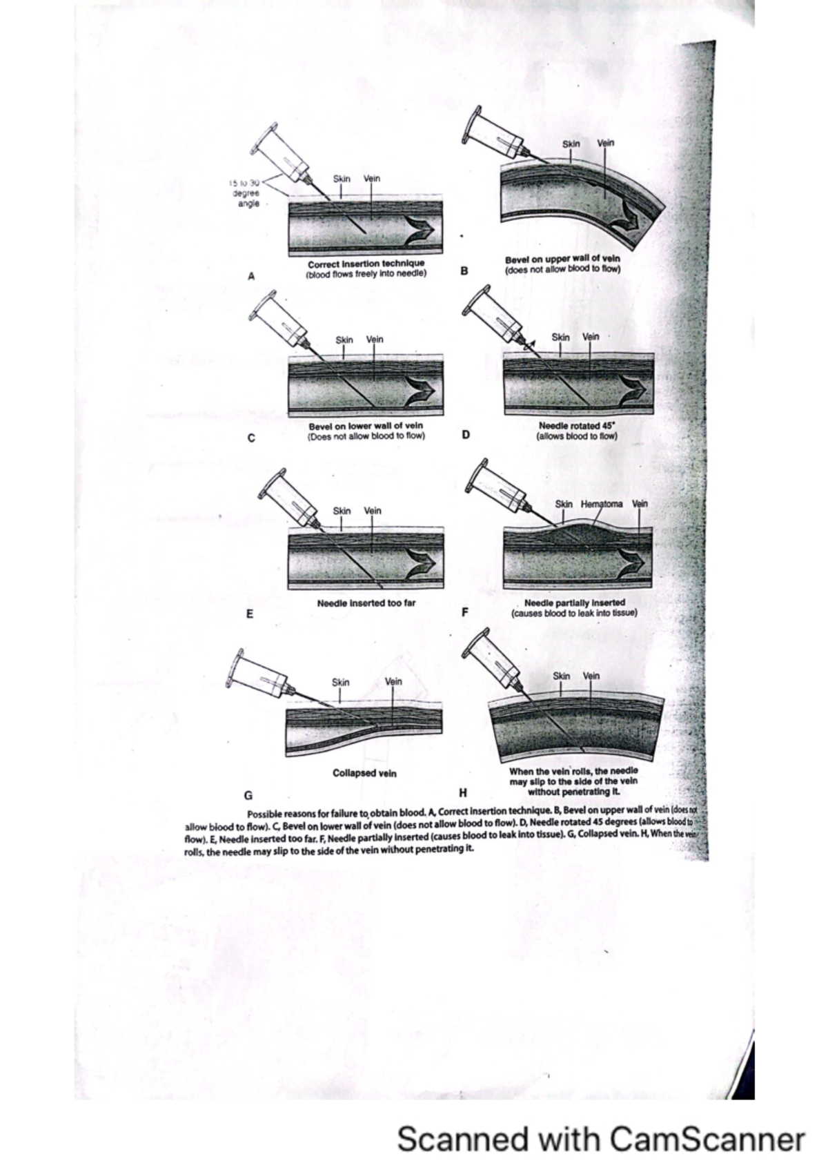 clinical chemistry lecture notes part 1 - Skin Vein 15 to 30 Skin Vein ...