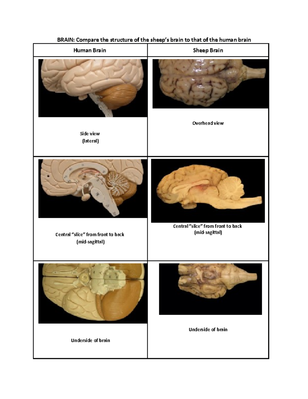 Brain-Nerve Lab Report - BRAIN: Compare the structure of the sheep’s ...