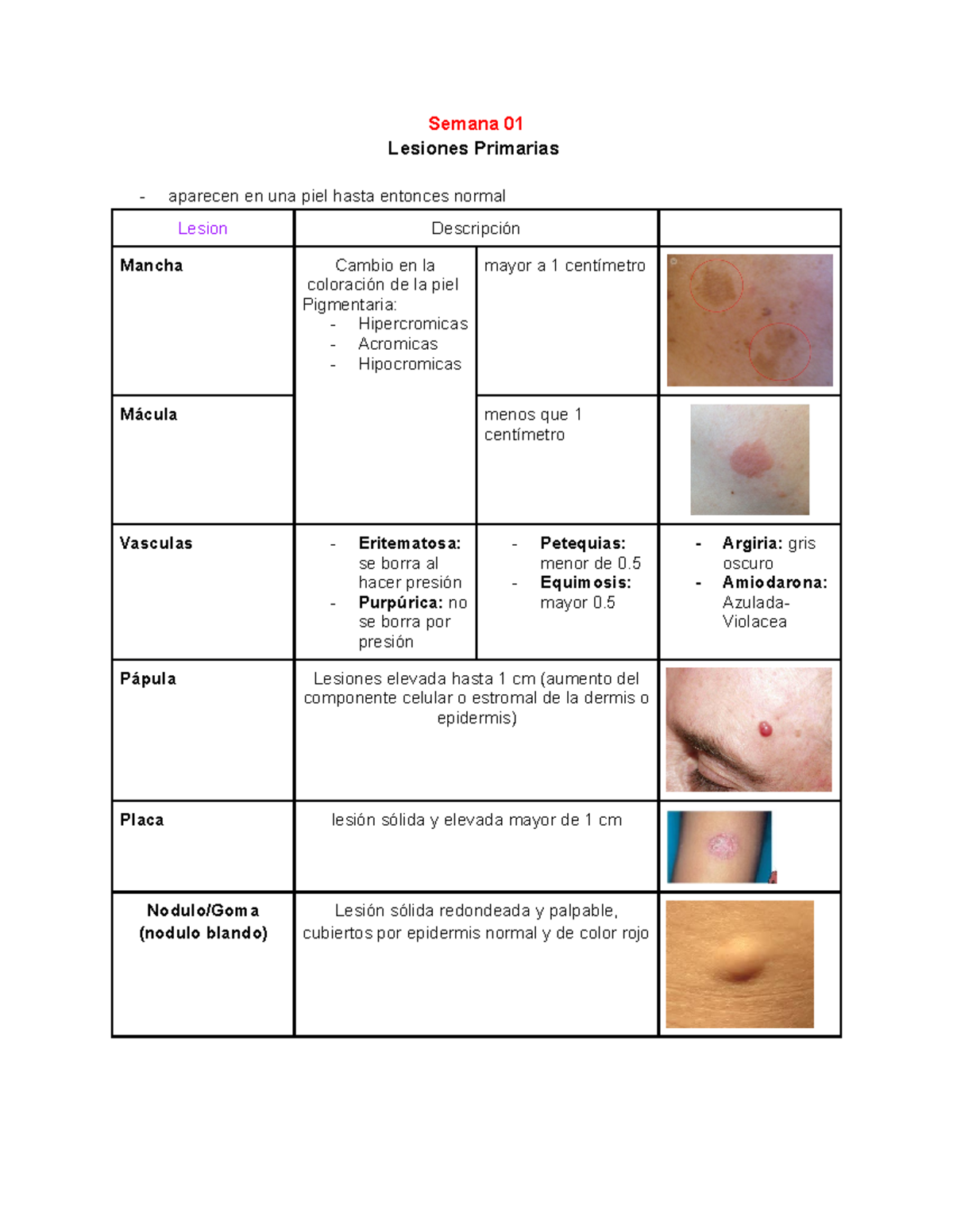 Lesiones EN LA PIEL - Semana 01 Lesiones Primarias aparecen en una piel ...