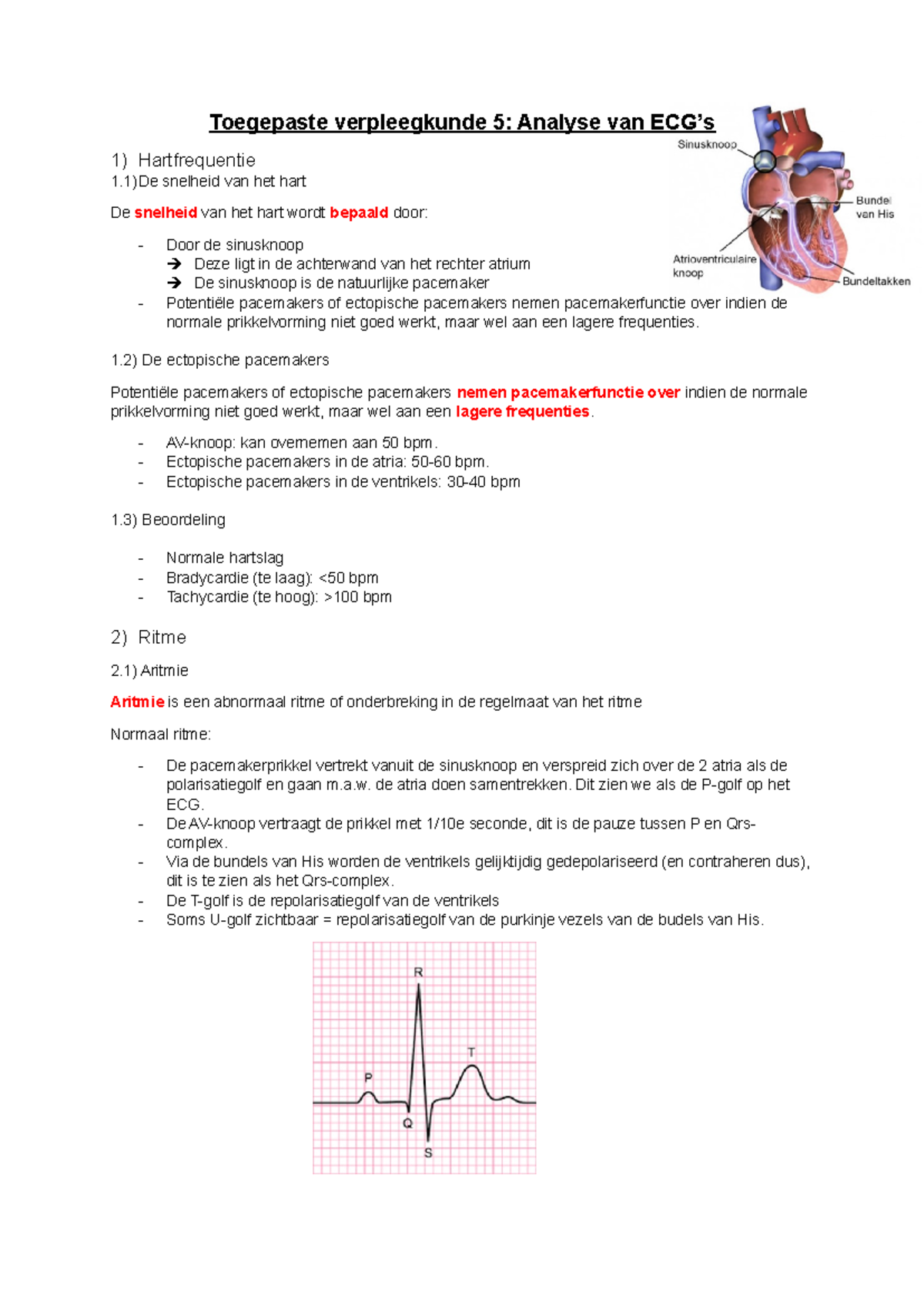 TV5 ECG-analyse - ecg - Toegepaste verpleegkunde 5: Analyse van ECG’s 1 ...