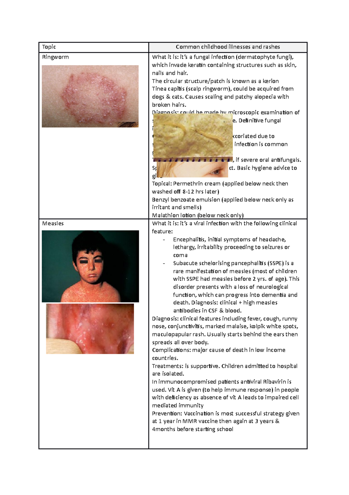 Common childhood illnesses and rashes - The circular is known as a ...