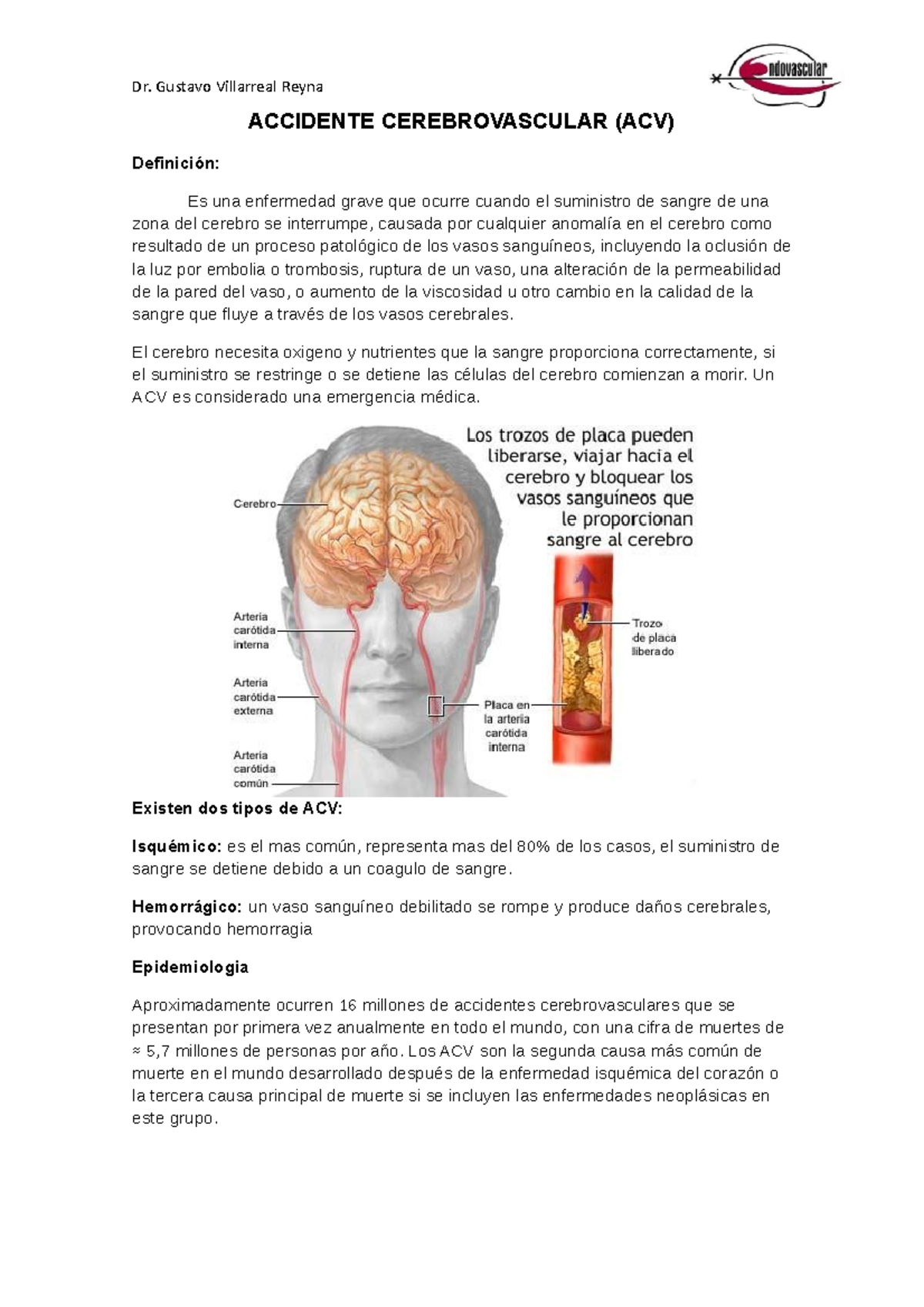 Accidente cerebrovascular - ACCIDENTE CEREBROVASCULAR (ACV) Definición ...