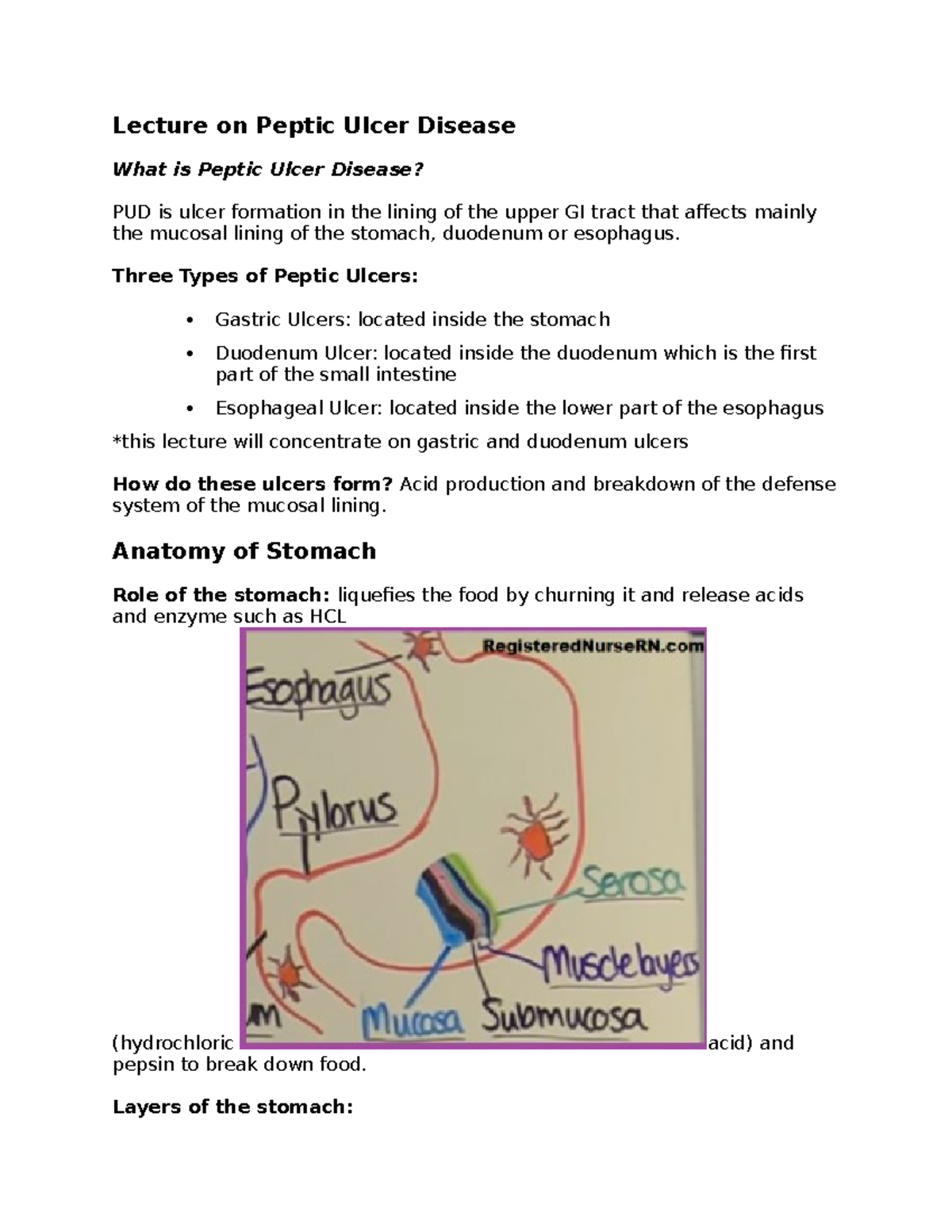 Peptic Ulcer Disease Nclex Review - Lecture on Peptic Ulcer Disease ...