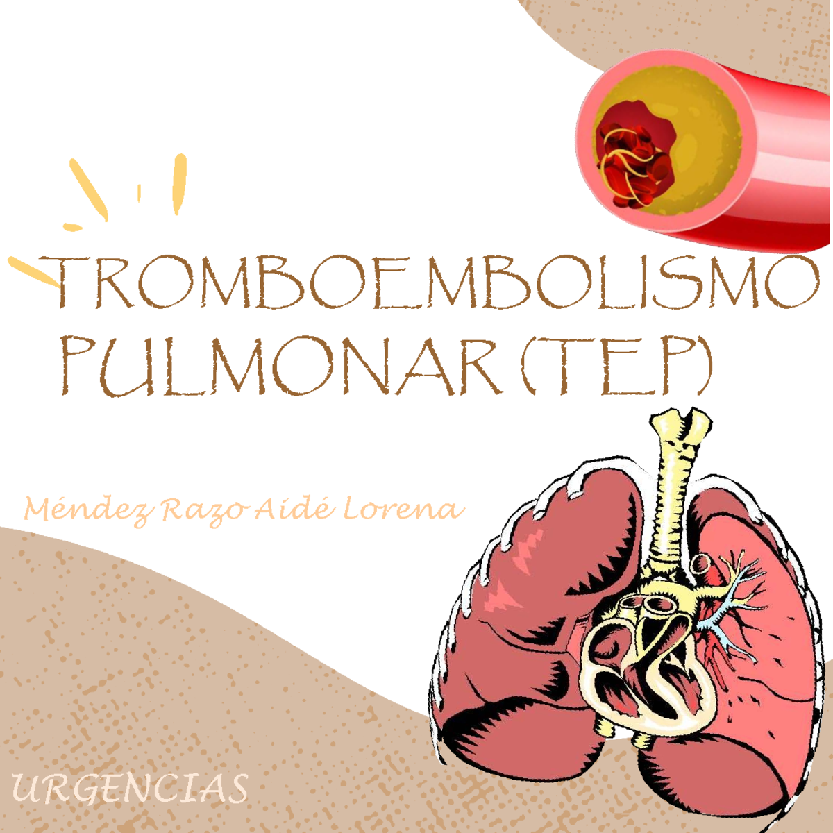 Tep borrador - EXPOSICION - TROMBOEMBOLISMO MÈndez Razo AidÈ Lorena ...