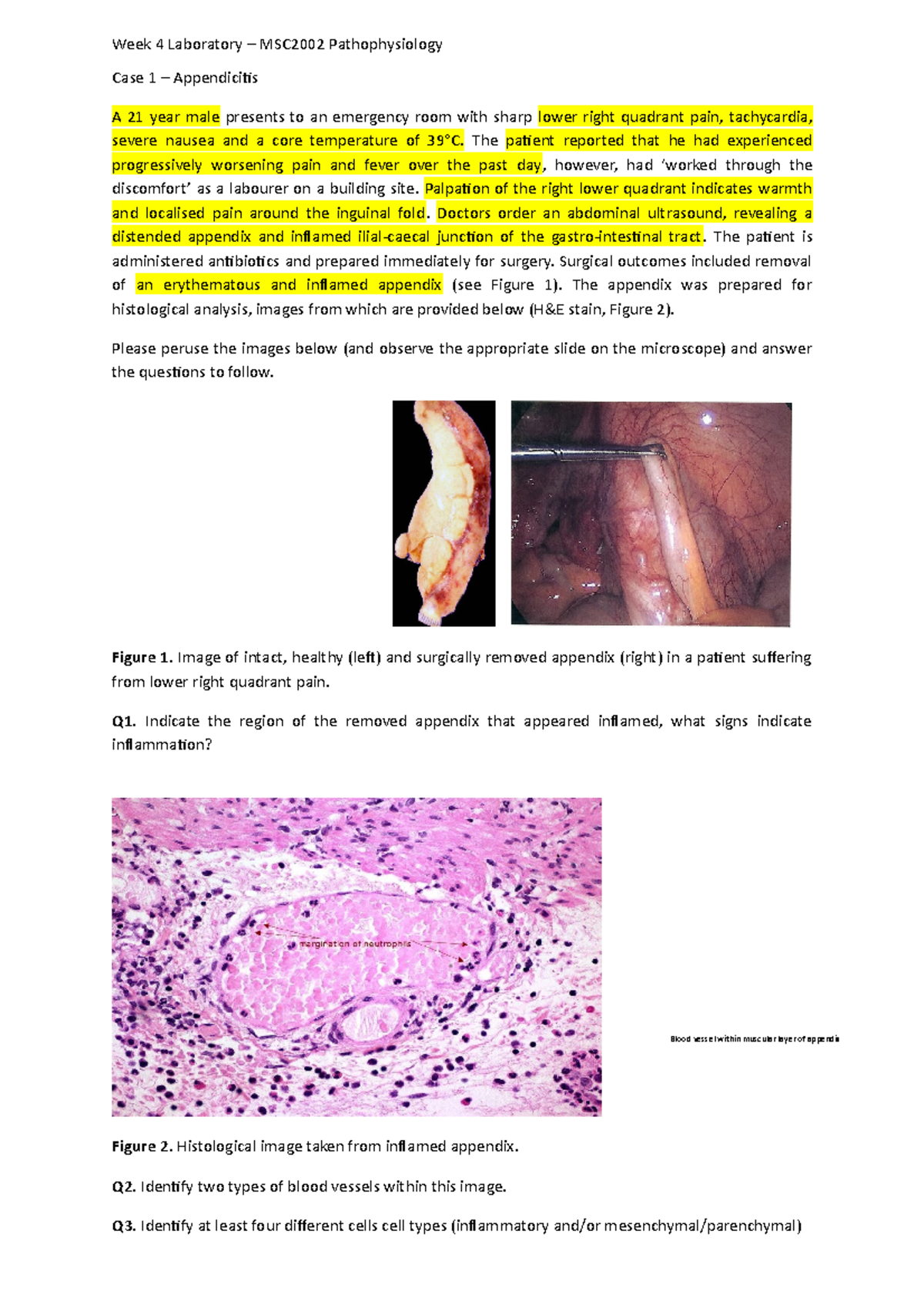 Case 1 - Acute appendicitis Pending - Week 4 Laboratory – MSC2002 ...