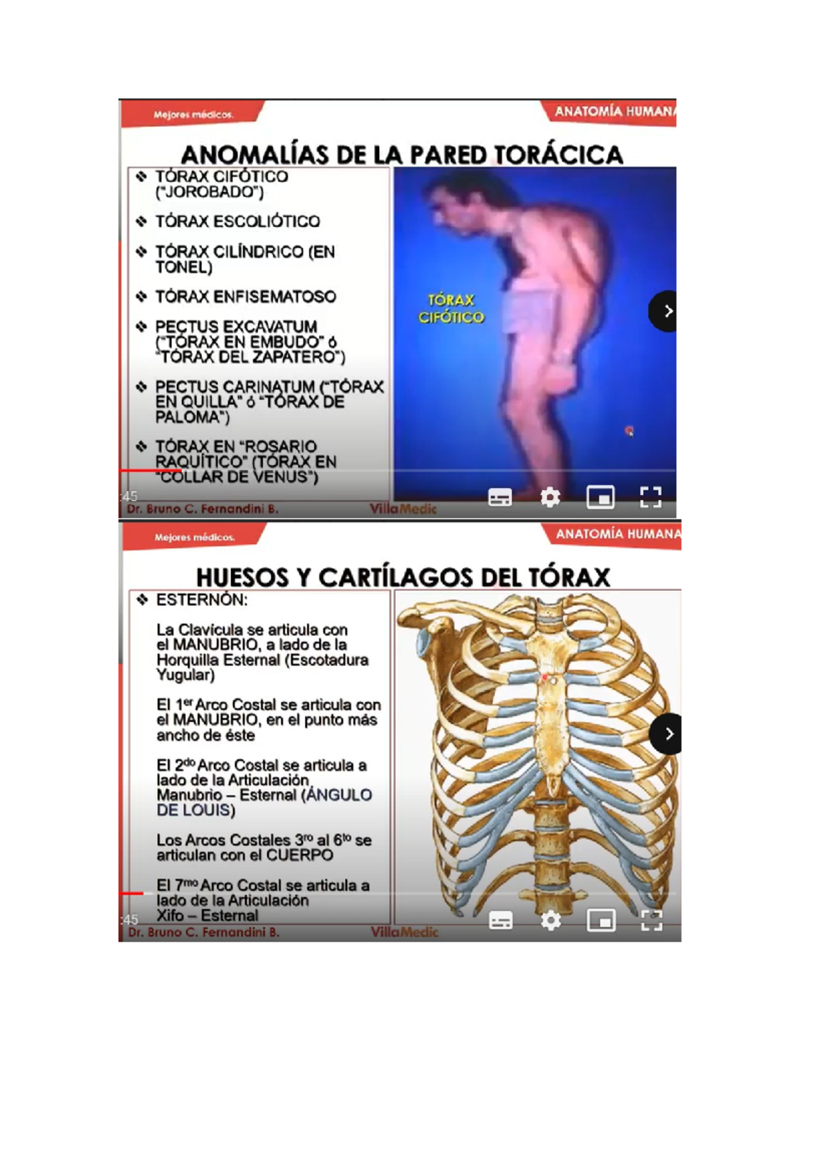 Tórax Resumen - Notas - Mejores médicos. ANATOMÍA HUMAN ANOMALÍAS DE LA ...