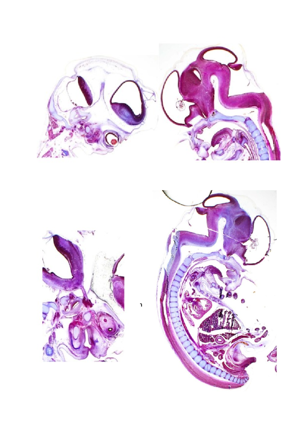 ANHB2212 fetal anatomy slides - ANHB2212 - al es. al es. B A D C ds B A ...