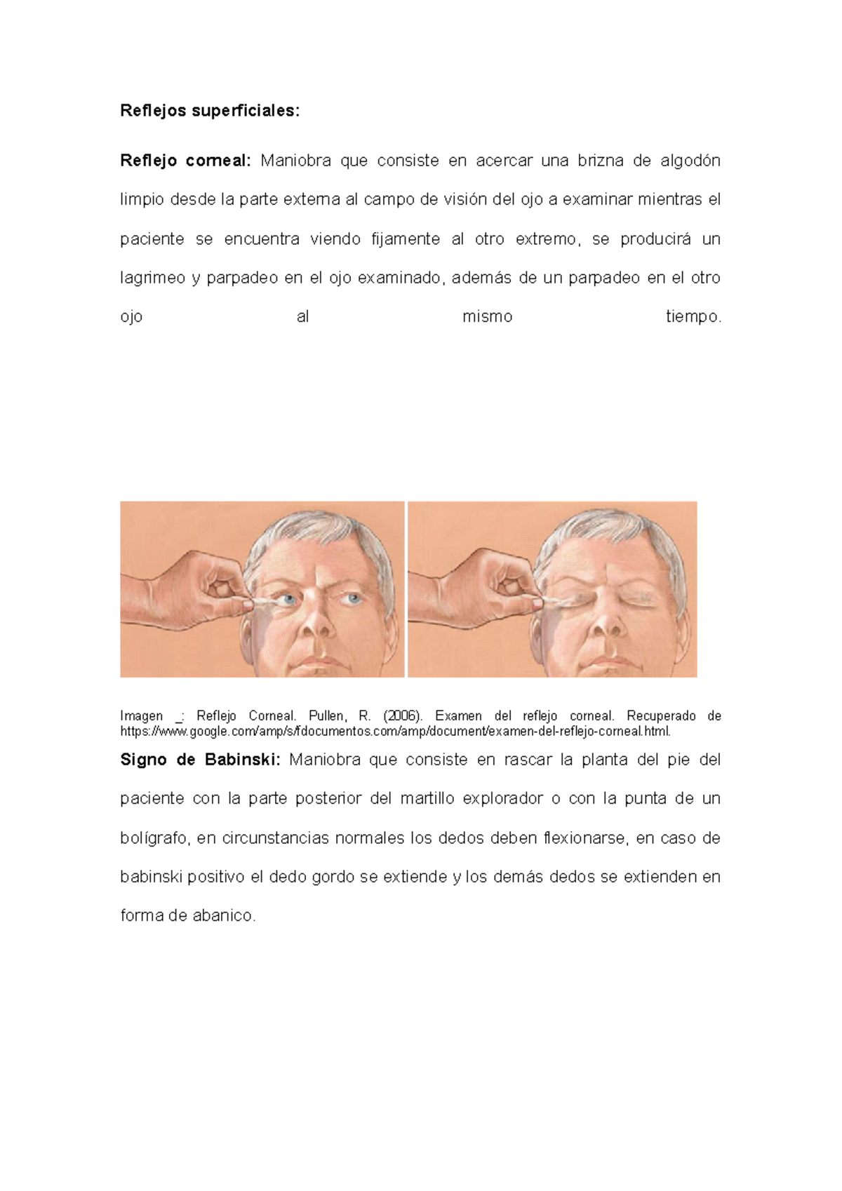 Reflejos superficiales - Reflejos superficiales: Reflejo corneal ...