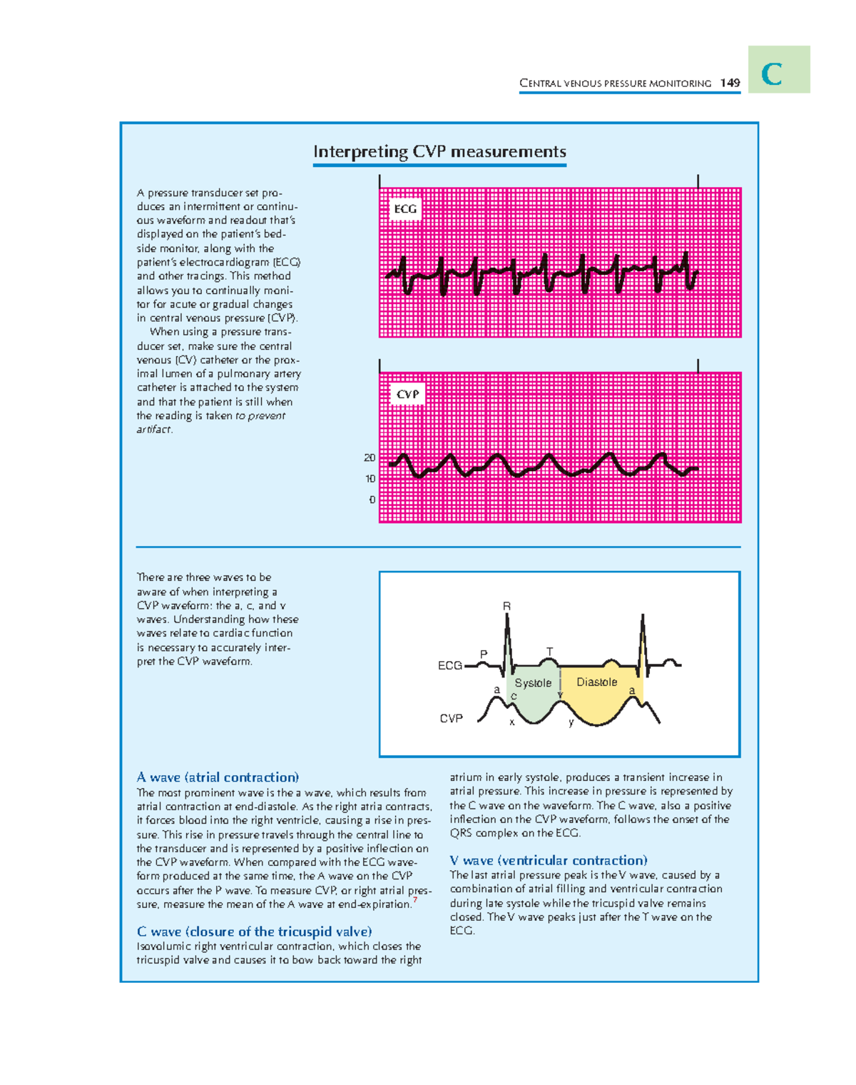 Nursing procedures 38 - CENTRAL VENOUS PRESSURE MONITORING 149 C ...