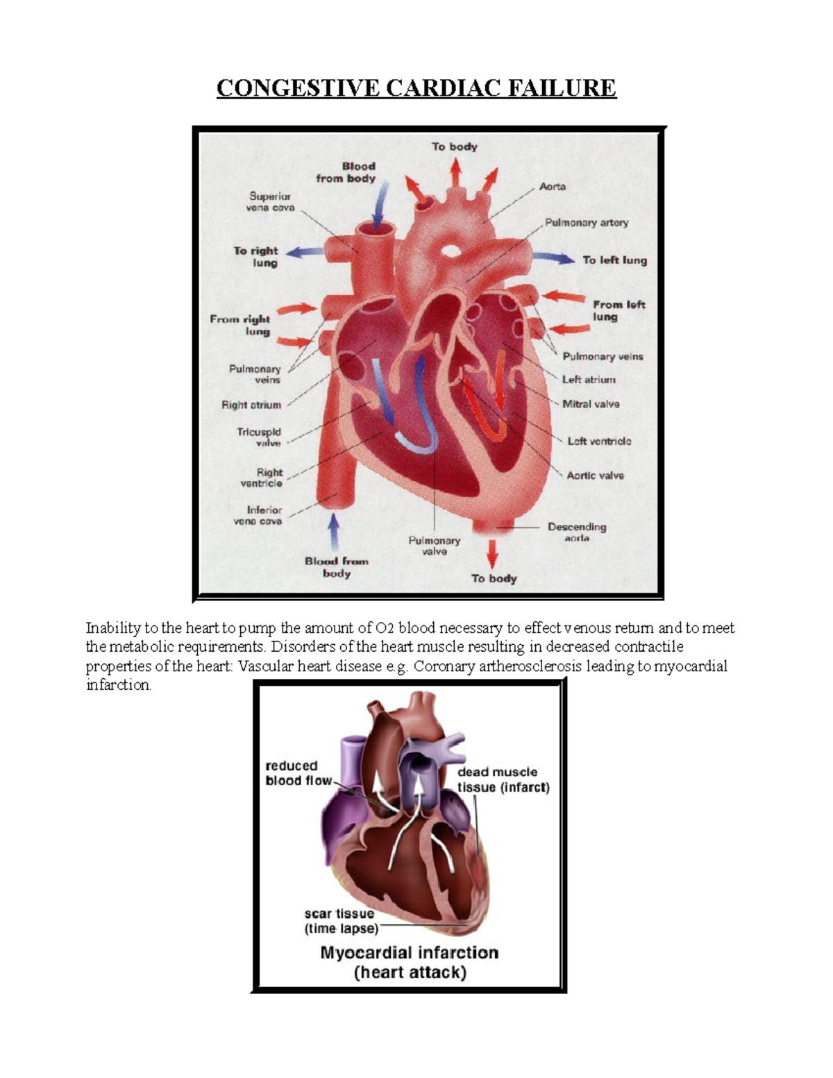 1 Congestive Cardiac failure - CONGESTIVE CARDIAC FAILURE Inability to ...