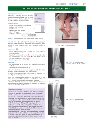 AP OBLIQUE PROJECTION—MEDIAL OR LATERAL ROTATION: TOES - Some ...