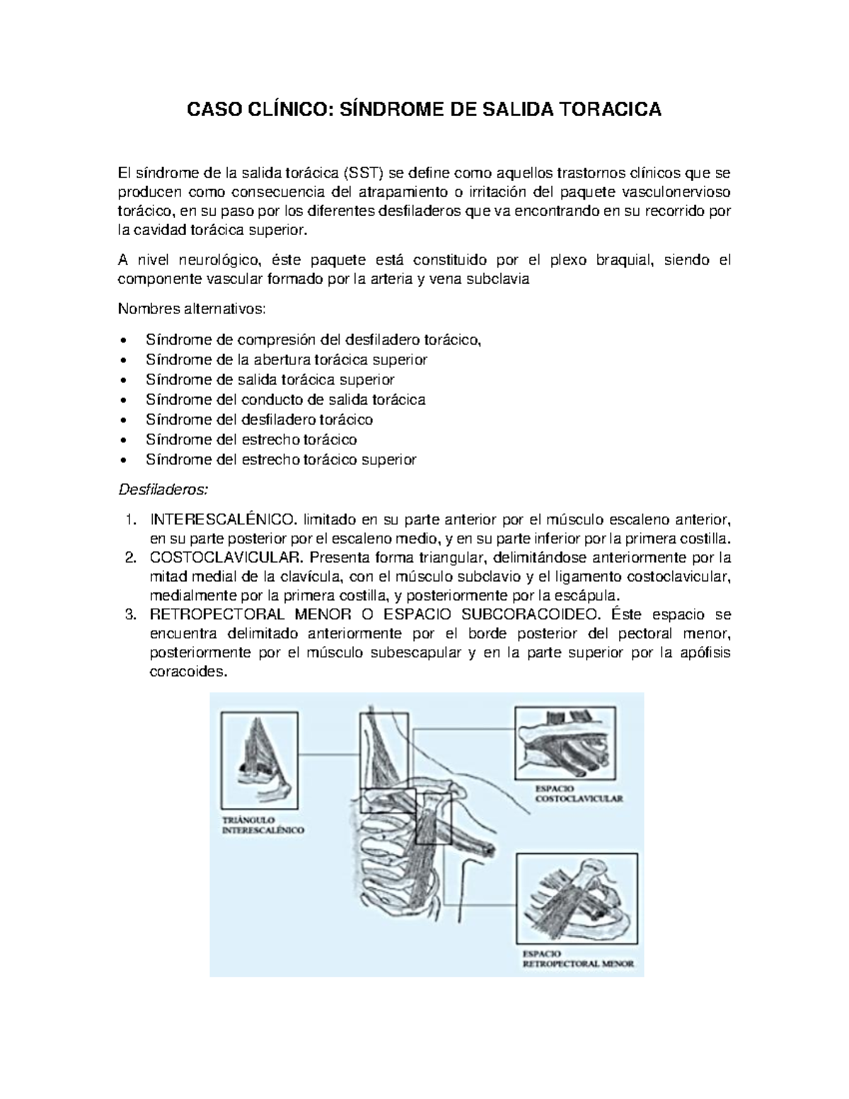 CASO Clínico. Síndrome de Salida Torácica - Warning: TT: undefined function: 32 CASO CLÍNICO ...