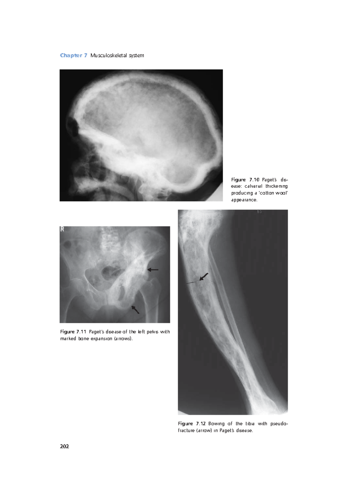Radiology Lecture Notes pdf (68) - Chapter 7 Musculoskeletal system 202 ...