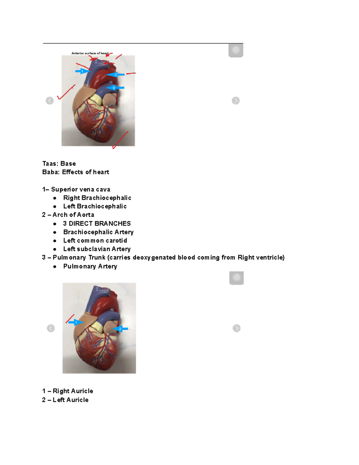 Circulatory-Lab - need for my lab - Taas: Base Baba: Effects of heart 1– Superior vena cava ...