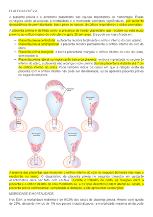 Resumo Anatomia da Pelve Feminina - ANATOMIA DA PELVE FEMININA PAREDE ...