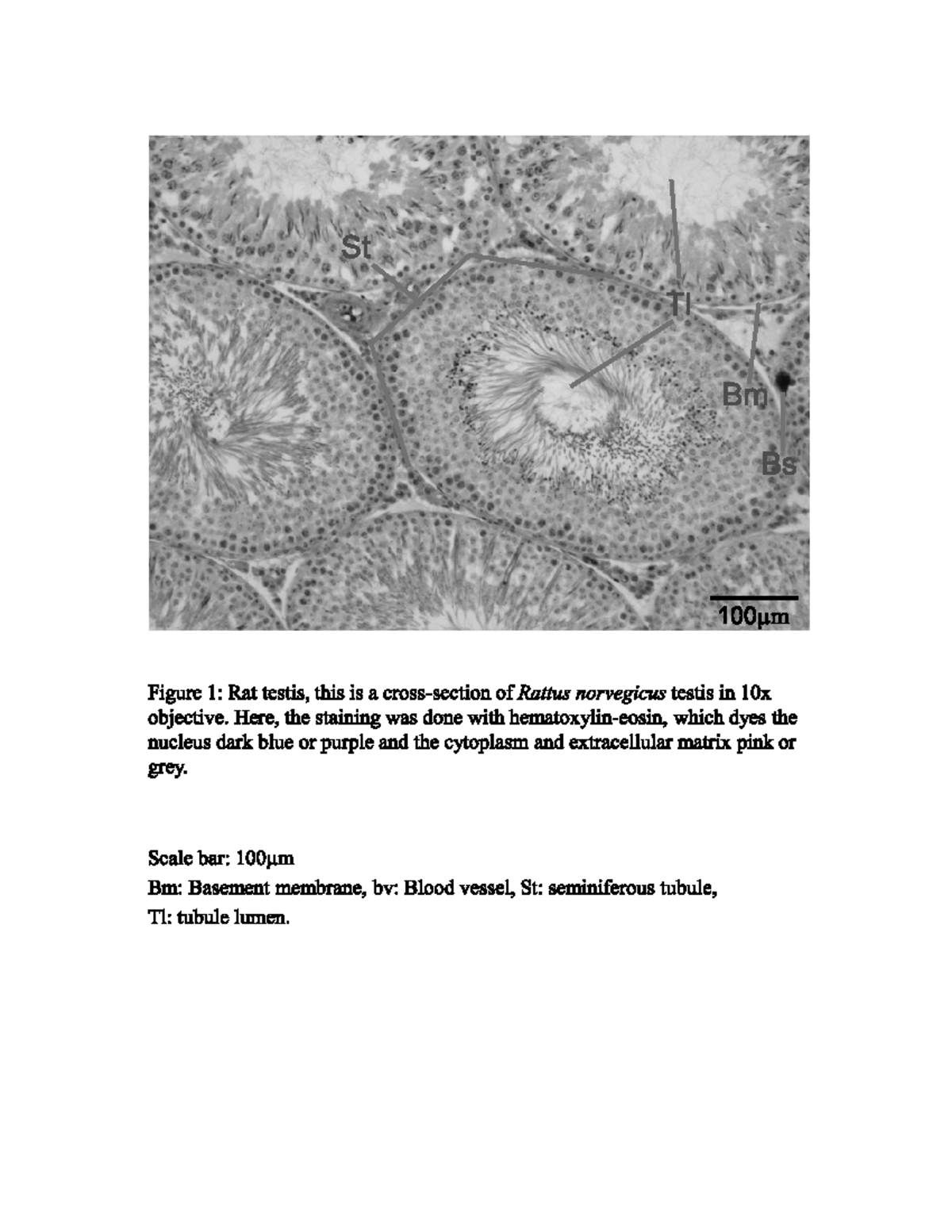 Testes lab doc - BIO1140 - St Bm 100 um Figure 1: Rat testis, this is a ...