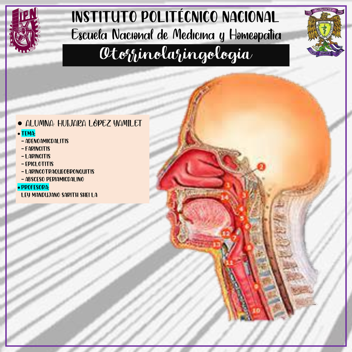 Resumen de adenoamigdalitis causada por varios agentes - Instituto ...