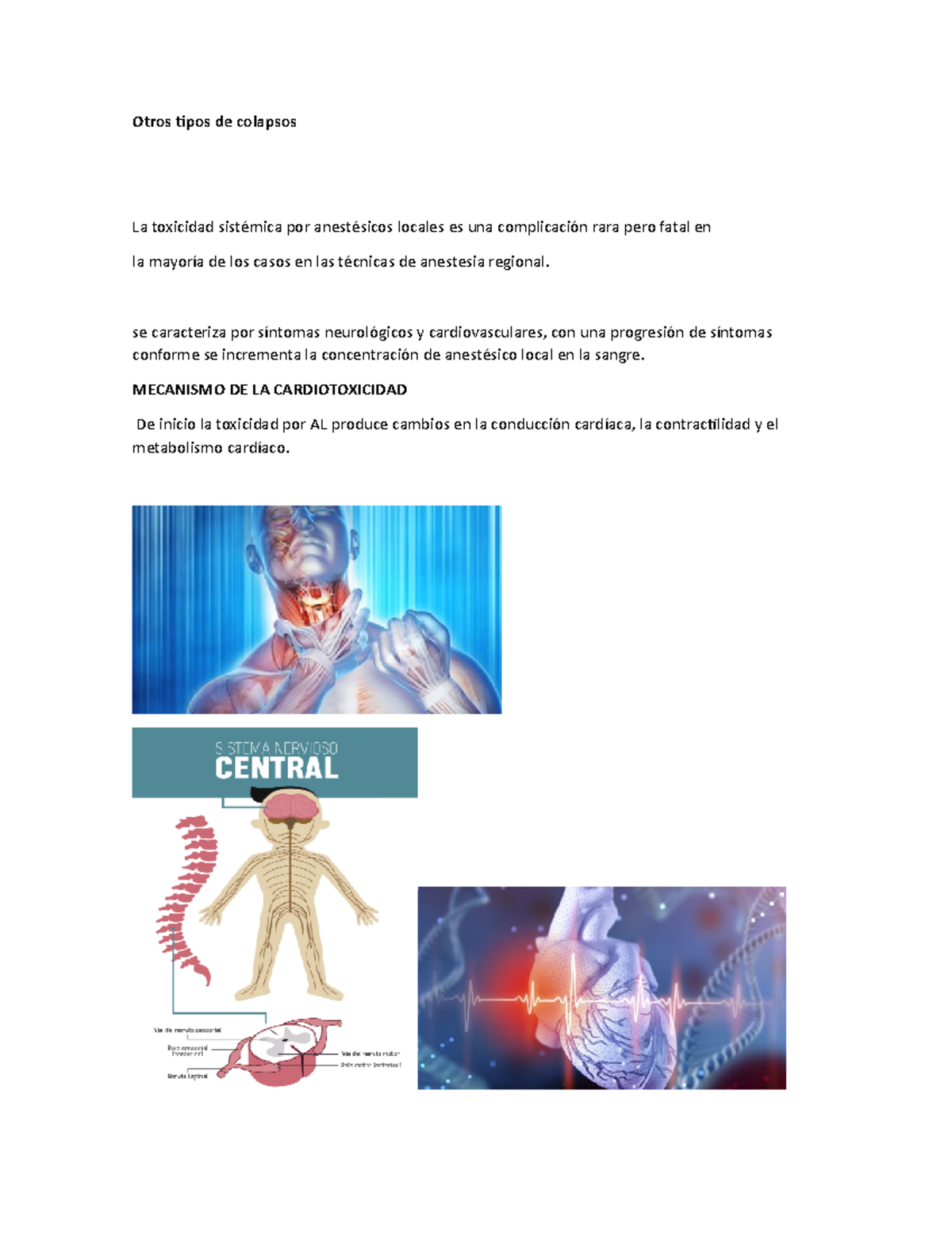 Otros colapsos instituto politecnico nacional - Otros tipos de colapsos ...