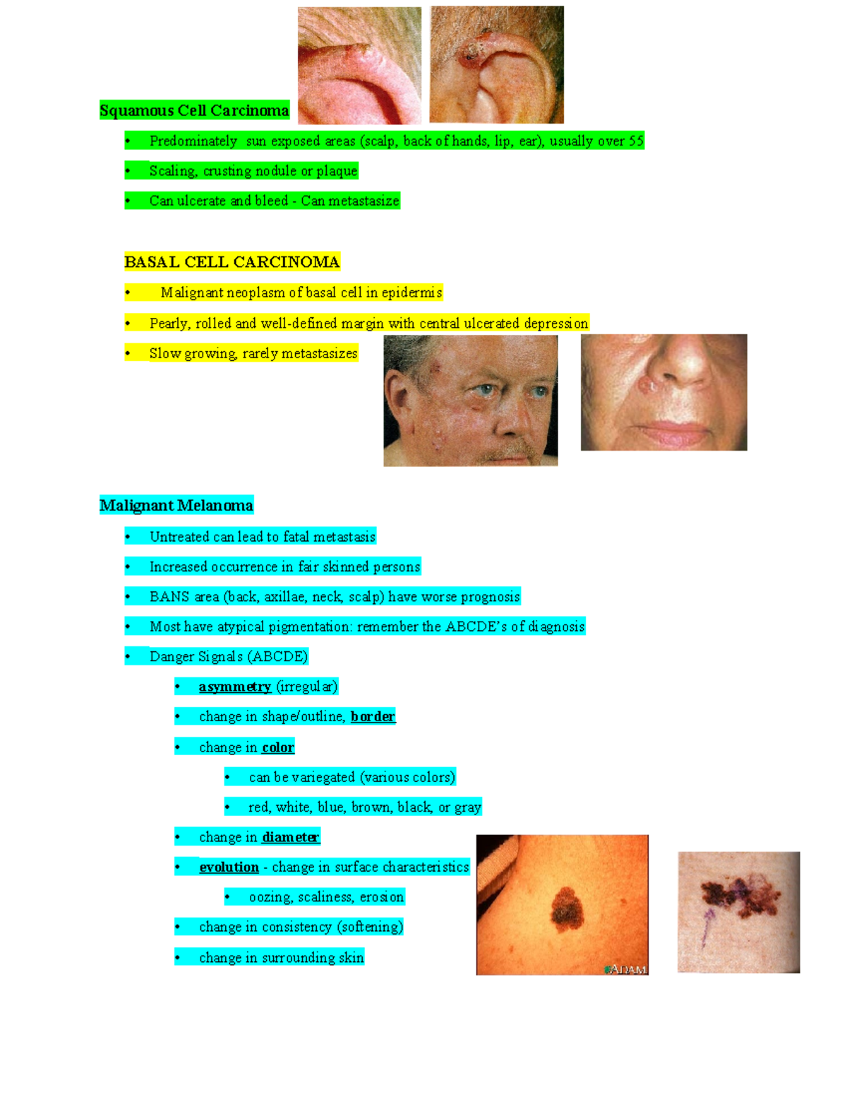 Skin Conditions - Squamous Cell Carcinoma Predominately sun exposed ...