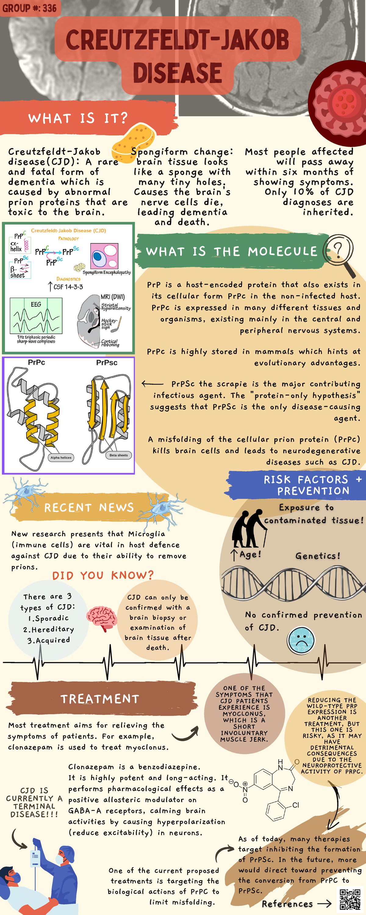 Creutzfeldt-Jakob Disease Treatment Research at Frank Duke blog