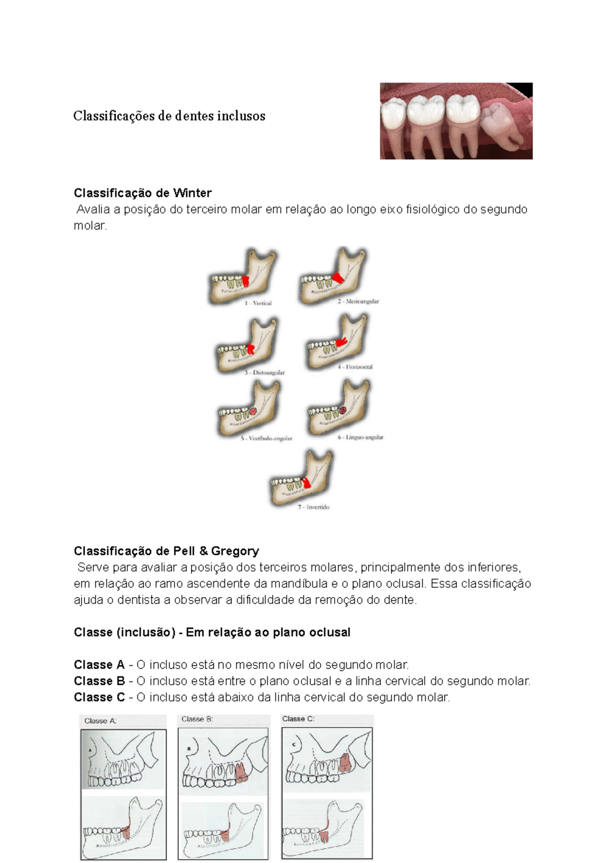 Classificações de dentes inclusos - Classificações de dentes inclusos ...