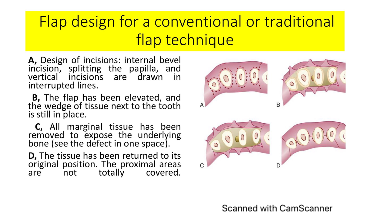 Periodontal Flaps Techniques 2 - Applied Dental Science - Studocu