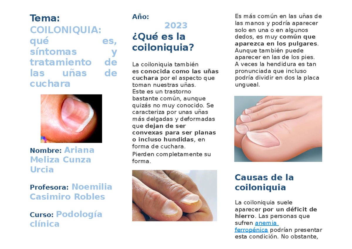 Coiloniquia ari - tarea - Tema: COILONIQUIA: qué es, síntomas y ...