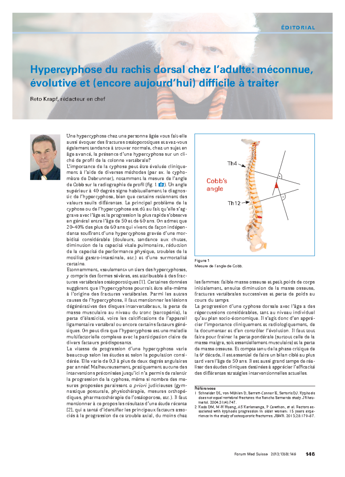 Hypercyphose du rachis dorsal chez l’adulte: méconnue, évolutive et ...