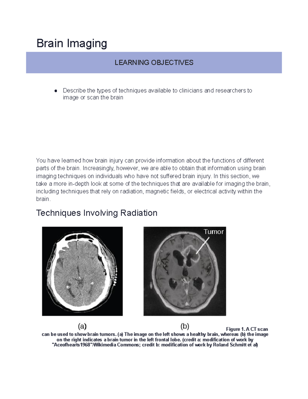 Brain Imaging - notes for course work - Brain Imaging LEARNING ...