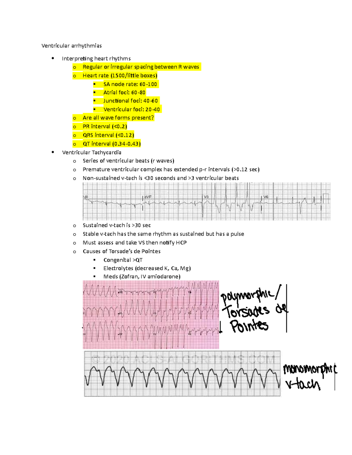 Exam 5 study guide - N/A - Ventricular arrhythmias Interpreting heart rhythms o Regular or - Studocu