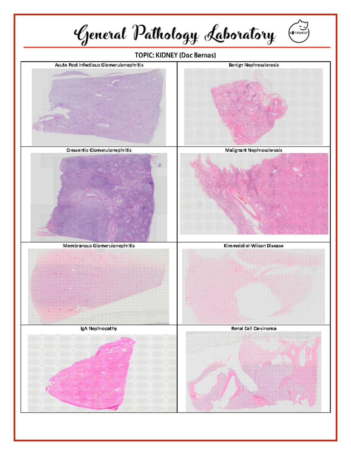 GEN PATH LAB- Kidney - Quick notes on general pathology - Acute Post ...