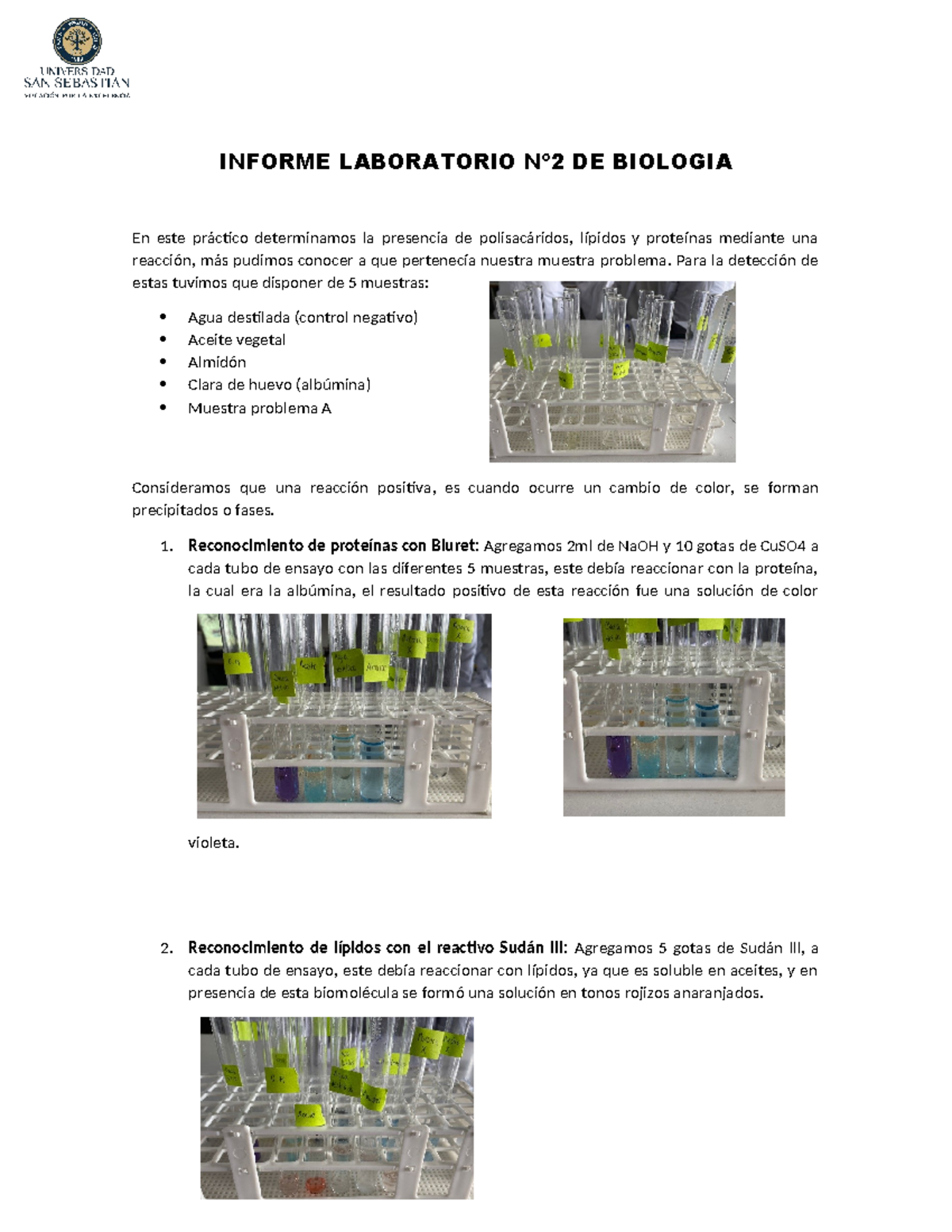 Informe Lab Bio Biomoleculas-1 - INFORME LABORATORIO Nº2 DE BIOLOGIA En este práctico ...