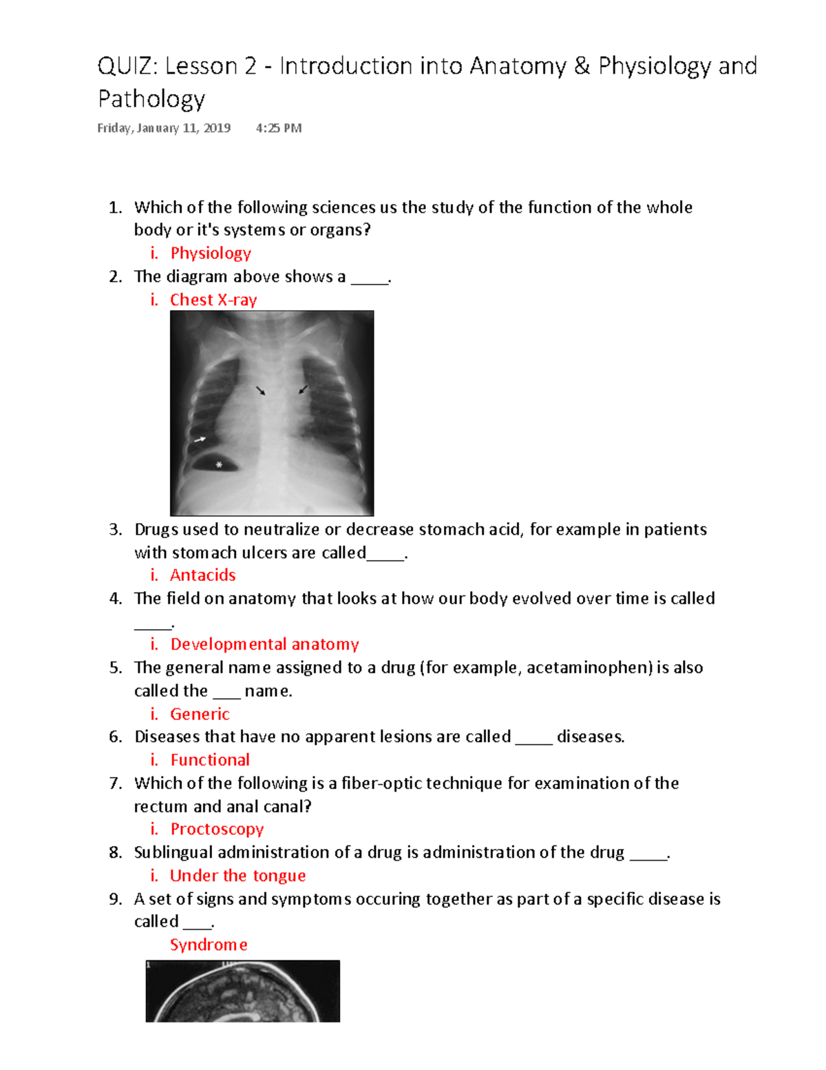 Health quiz 2- Introduction into anatomy and physiology and pathology ...
