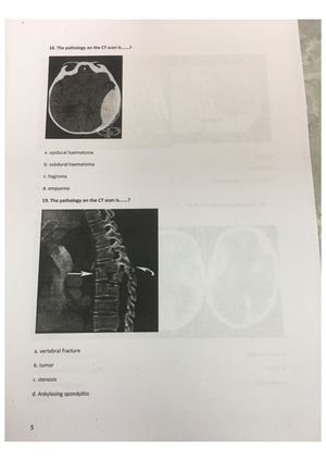 18. Brain compression: subdural hygroma and intracerebral haematoma ...