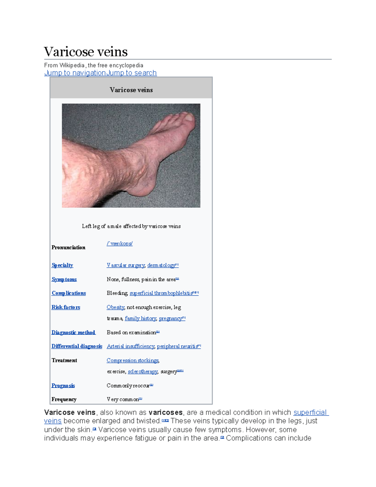 Varicose veins - Varicose veins From Wikipedia, the free encyclopedia ...