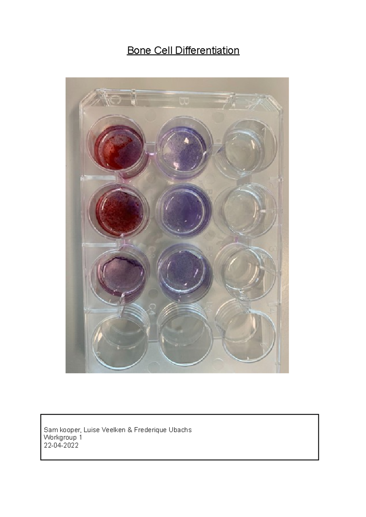 Verslag practicum bone cell differentiation - Bone Cell Differentiation ...