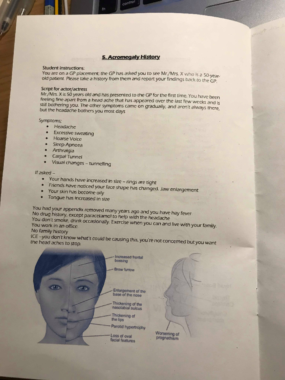 Acromegaly - Endocrine OSCE station and marksheet - A100 - Studocu