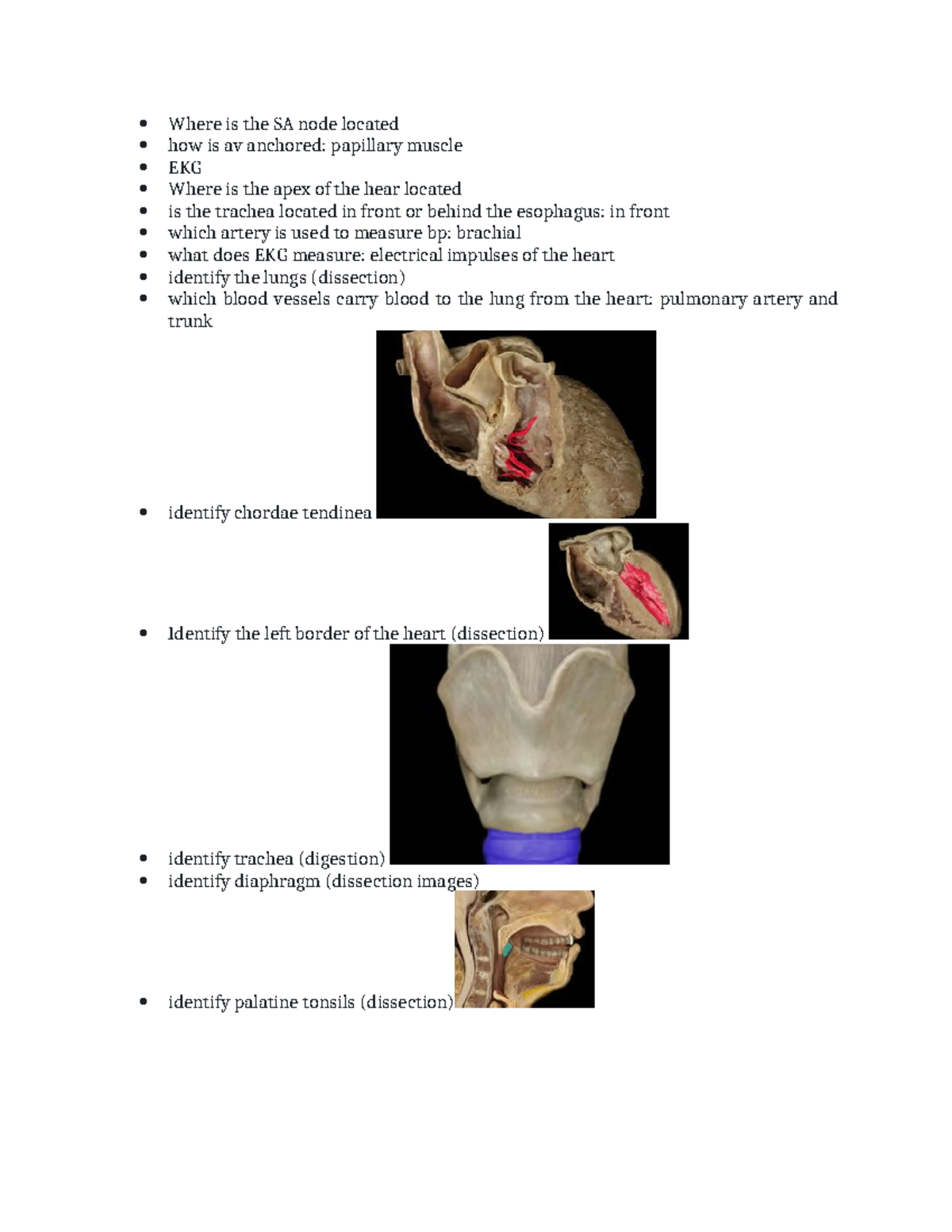 Lab exam 2 review - Where is the SA node located how is av anchored ...