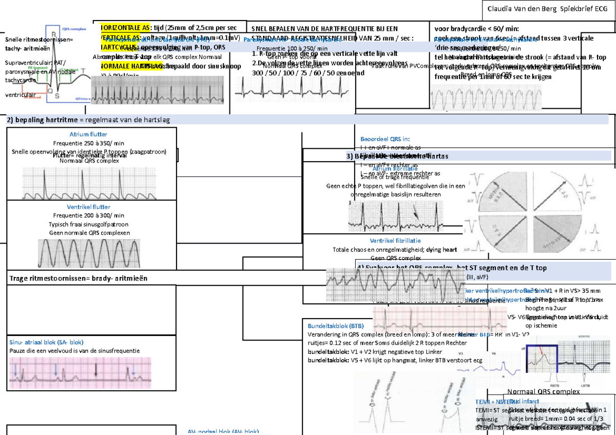 ECG - spiekbrief - 1) Bepaling hartfrequentie 2) bepaling hartritme ...